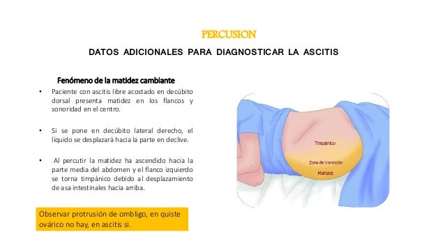 Semiologia de abdomen