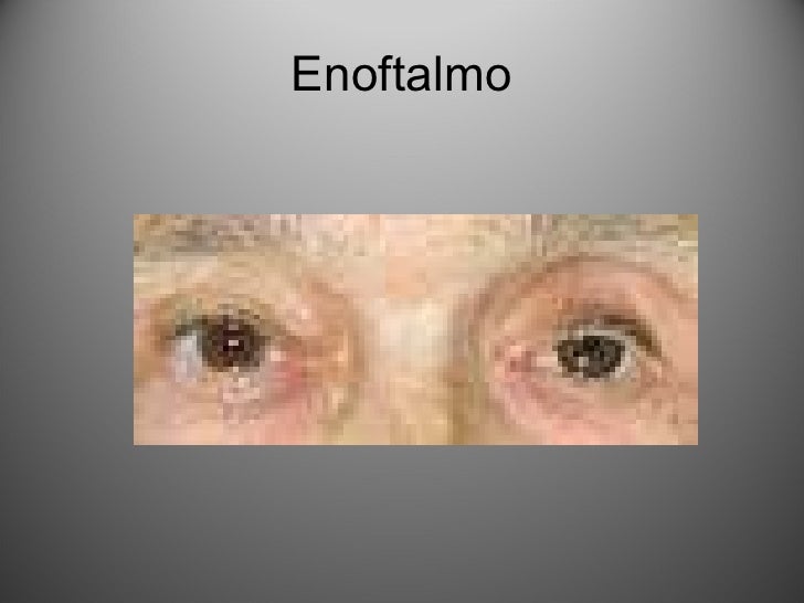 Semiologia De Cabeza I