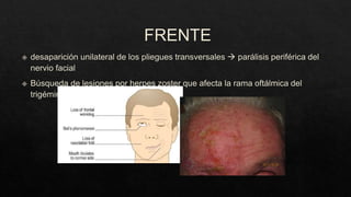 SEMIOLOGIA DE CABEZA Y CUELLO. Medicina Semiologia cabeza y cuellopptx ...