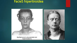 SEMIOLOGIA DE CABEZA Y CUELLO PARTE I.pptx