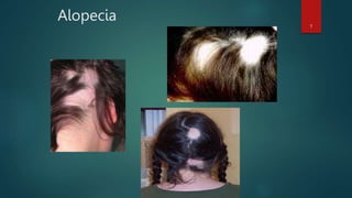 SEMIOLOGIA DE CABEZA Y CUELLO PARTE I.pptx