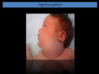 Semiologia de cuello | PPT