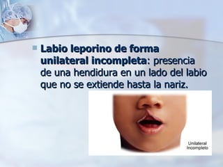 Semiologia quirurgica de la boca. artiles | PPT