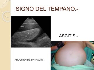 Semiologia del aparato digestivo tema | PPTX