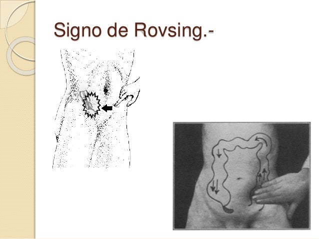 Semiologia del aparato digestivo tema