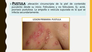 Semiologia de la piel | PPTX
