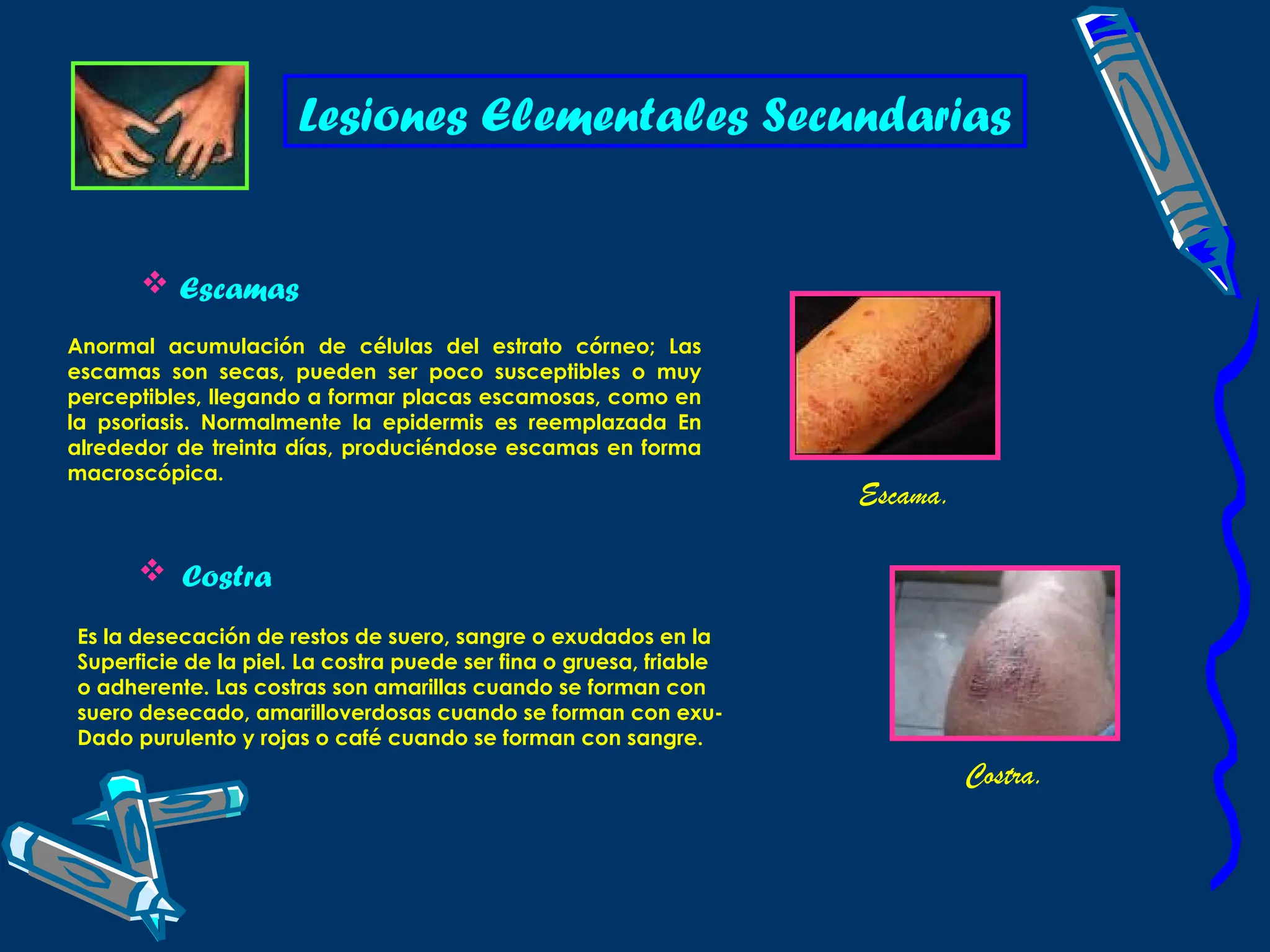 SEMIOLOGIA DE LA PIEL COMO NOTAS IMPORTANTES.pptx