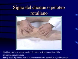 semiologia de la rodilla y anatomia aplicada | PPTX