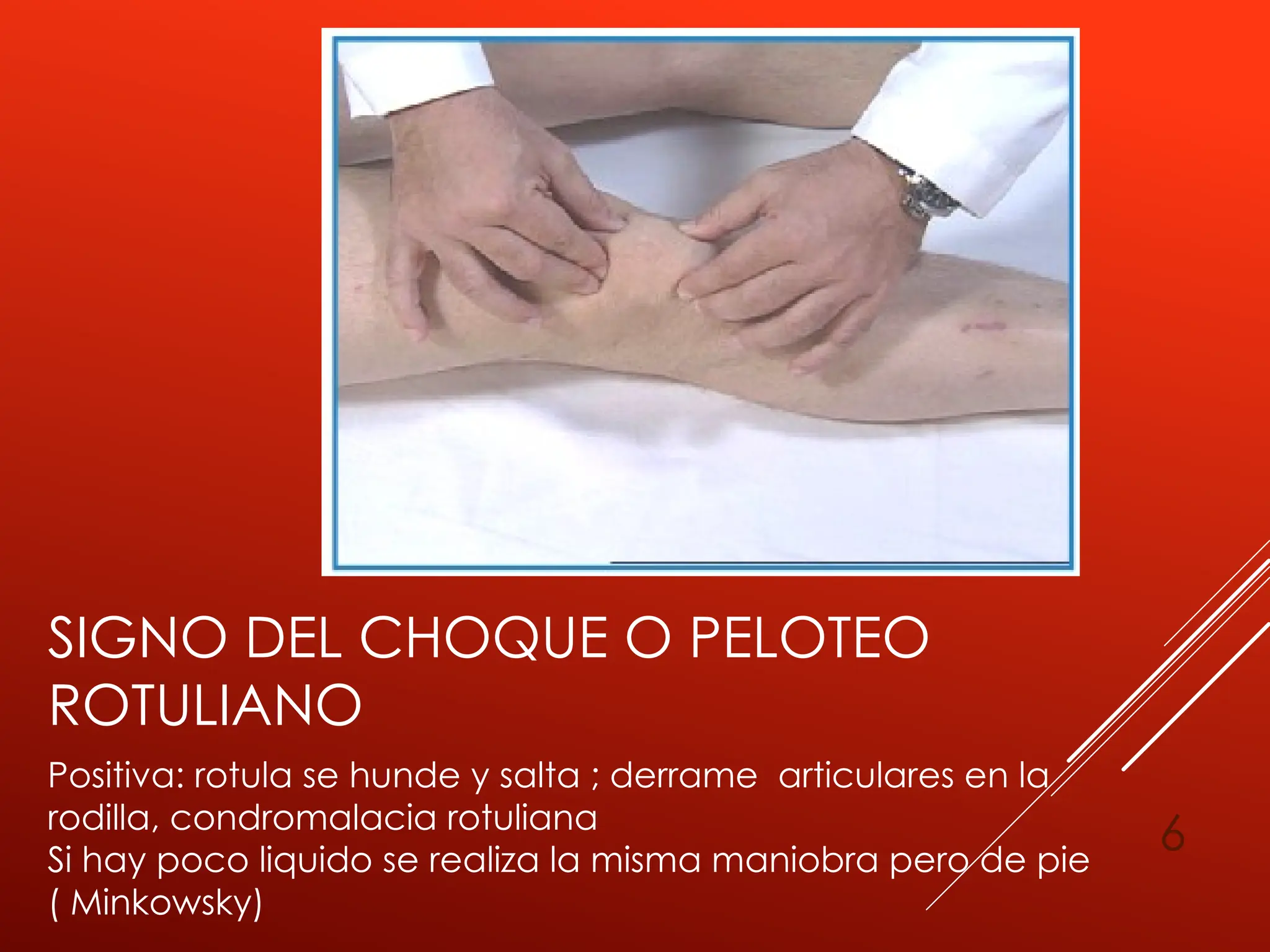 semiologia de la rodilla traumatologia evelio 2.pptx