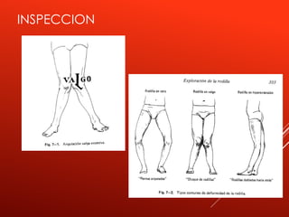 semiologia de la rodilla traumatologia evelio 2.pptx