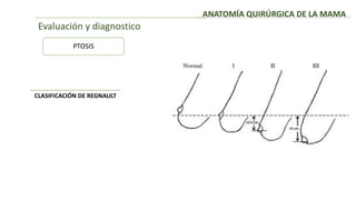 SEMIOLOGIA DE LAS MAMAS DR HANMER ROA 2020 PPTX SEMIOLOGIA DE LAS MAMAS DR HANMER ROA 2020 PPTX