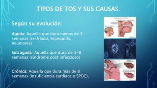 Semiologia de la Tos. Unerg Informarmacionpptx | PPTX