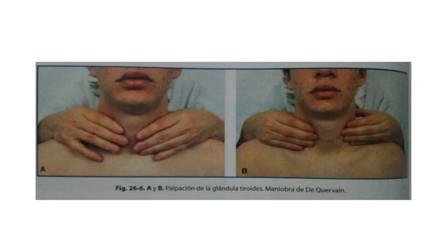Semiologia del cuello | PPTX