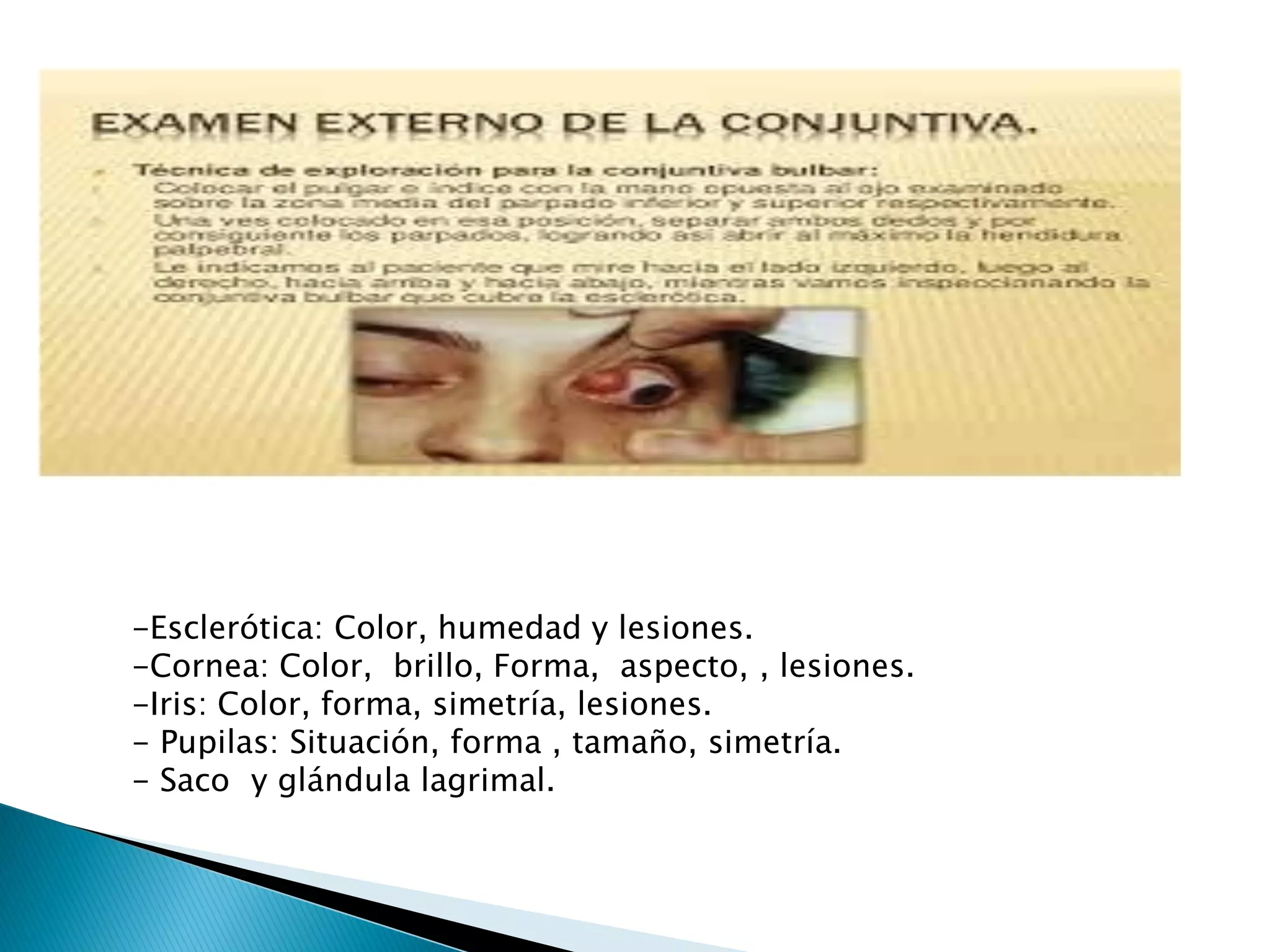 Semiologia del ojo . Exploracion Semiologica de II, III, IV y VI par ...