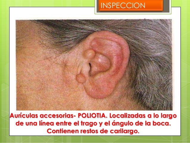 Semiologia de los oidos