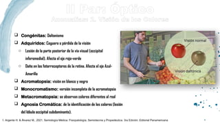 Semiología de los Pares Cranealesml.pptx