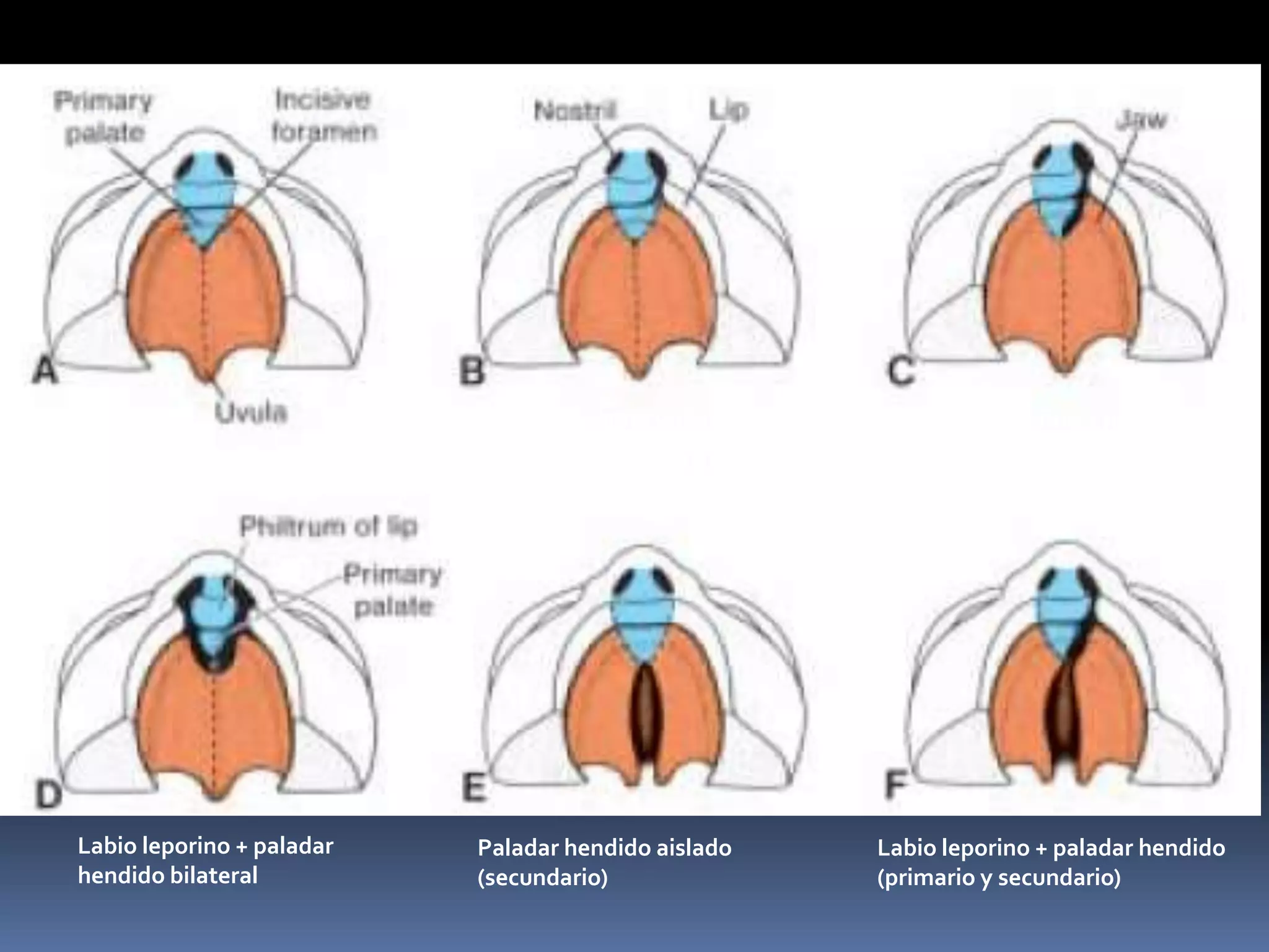 Semiologia del paladar | PPTX