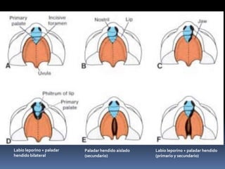 Semiologia del paladar | PPTX