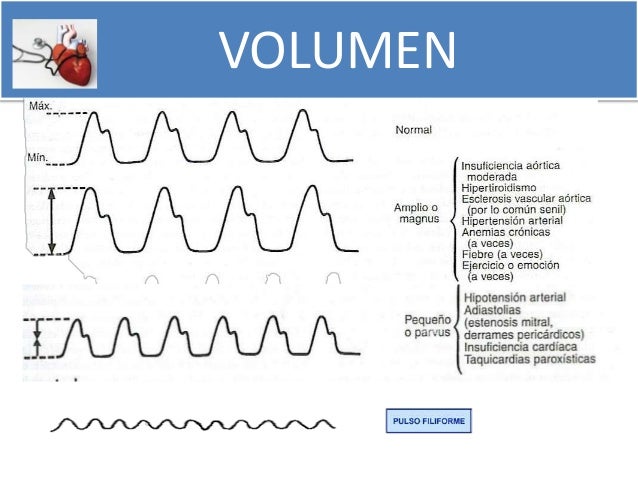 Semiologia del pulso