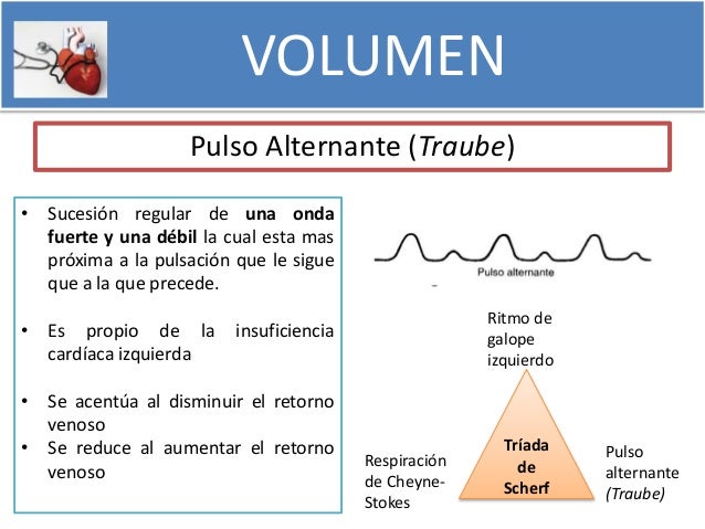 Semiologia del pulso