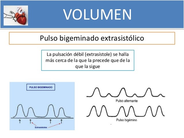 Semiologia del pulso