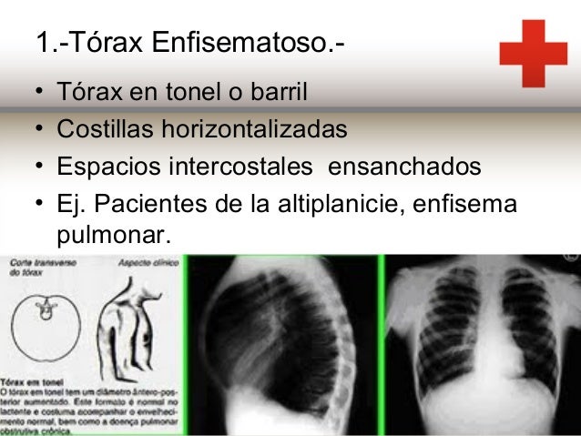 Semiologia del sistema respiratorio