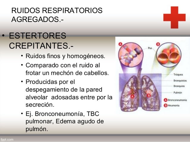 Semiologia del sistema respiratorio
