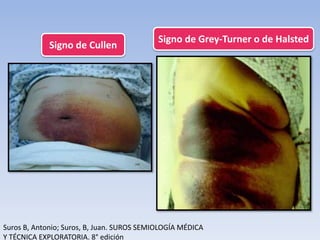Semiologiadepancreas 130809201233-phpapp02 (1) | PPTX