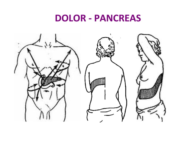 Semiologia de pancreas y vias biliares | PPT