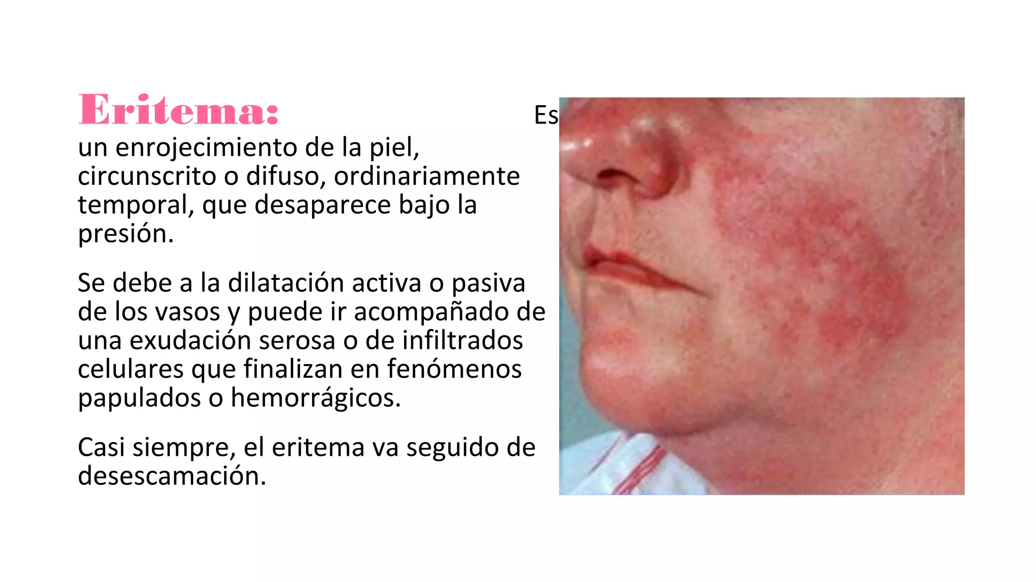 Semiologia de piel y anexos