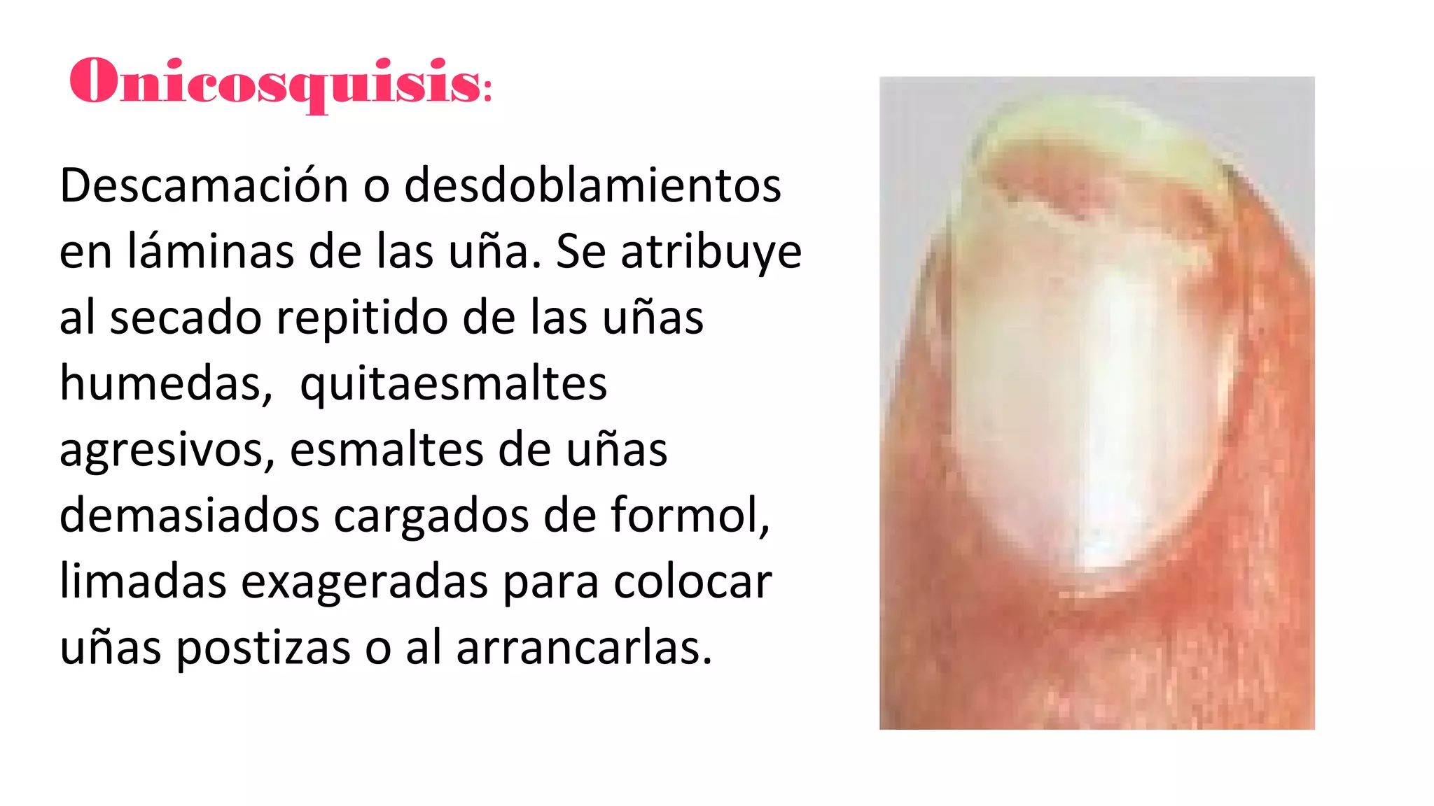 Semiologia de piel y anexos