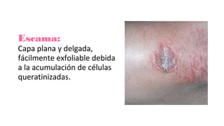 Semiologia de piel y anexos | PPT