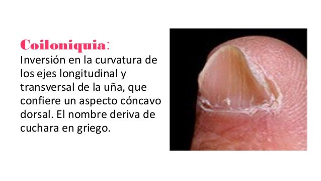 Semiologia de piel y anexos