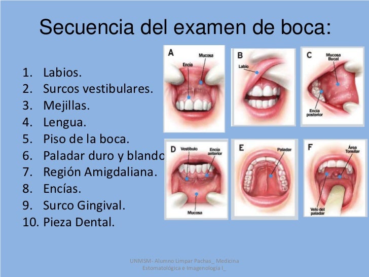 Semiologia de region labial carrillos y orofaringe