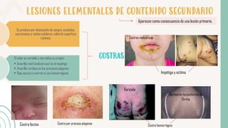 SEMIOLOGÍA DERMATOLÓGICA- CASTILLO, ARELLANO Y ESCOBAR SANTOS.pptx