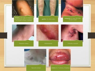 Semiologia Dermatologica OFICIAL.pptx