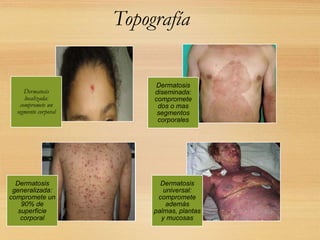 Semiologia Dermatologica Oficial Pptx