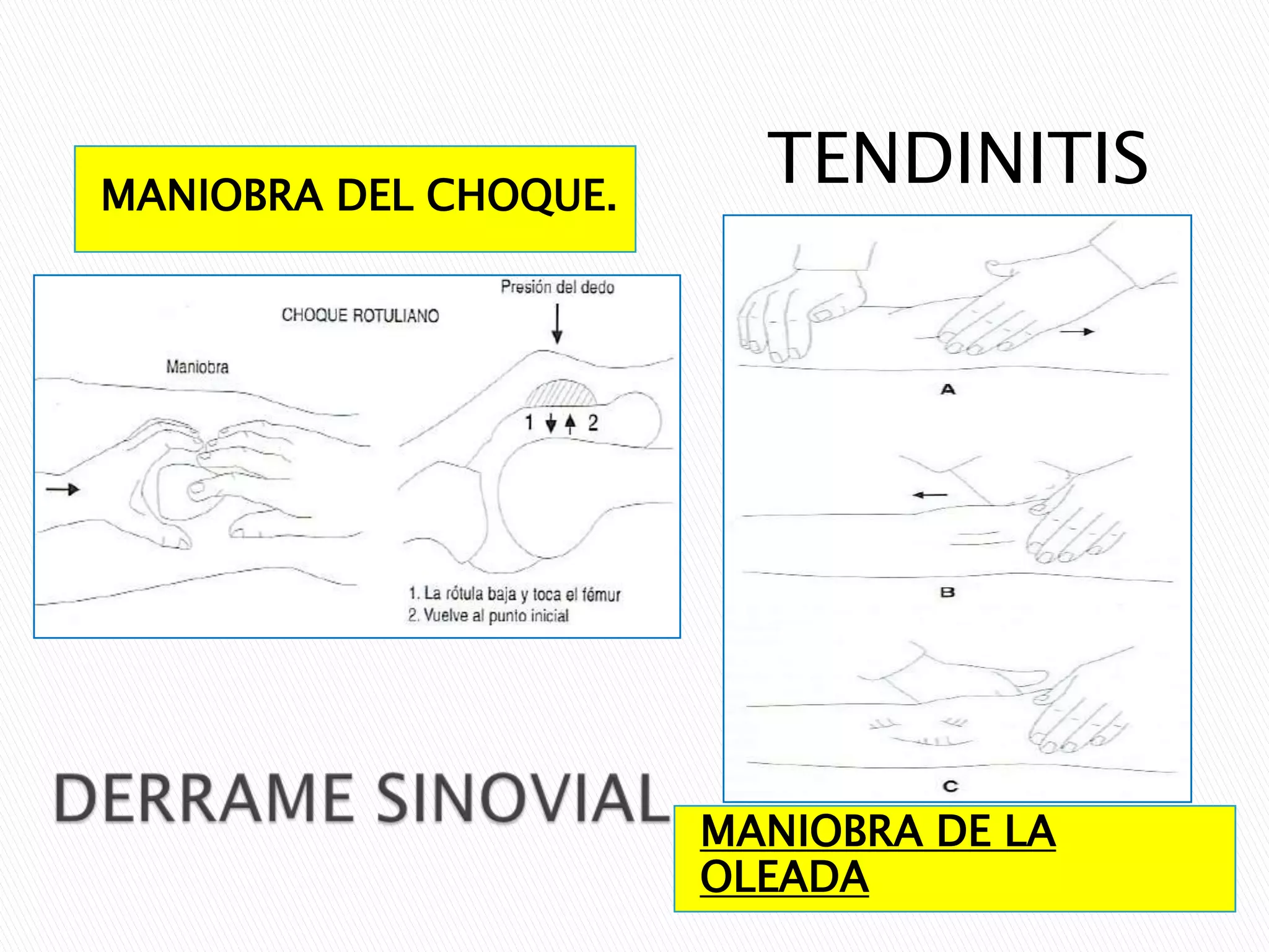 Semiologia de rodilla ORTOPEDIA 1 | PPTX