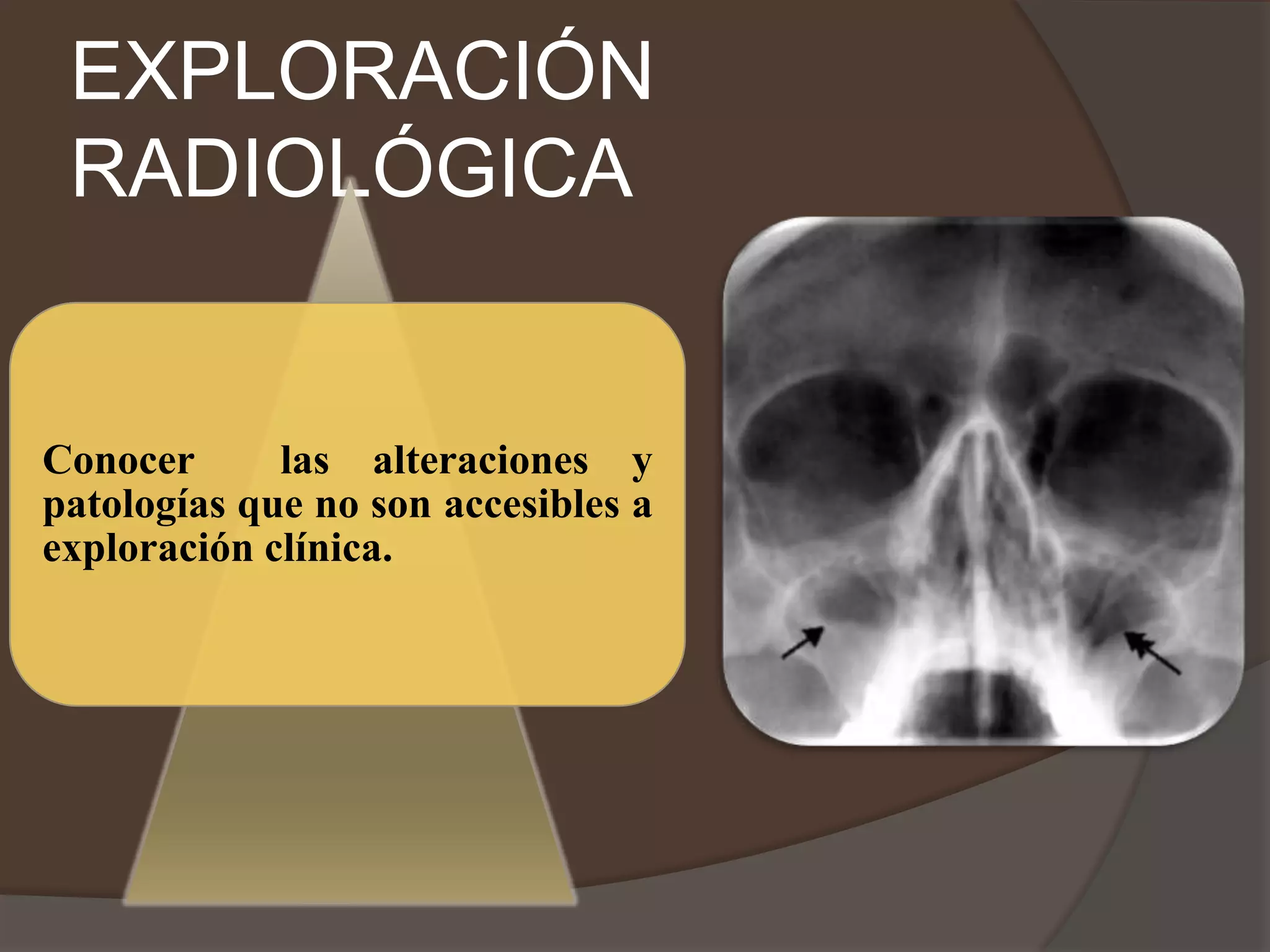 Semiologia de senos paranasales y radiologia y anatomia de seno maxil…