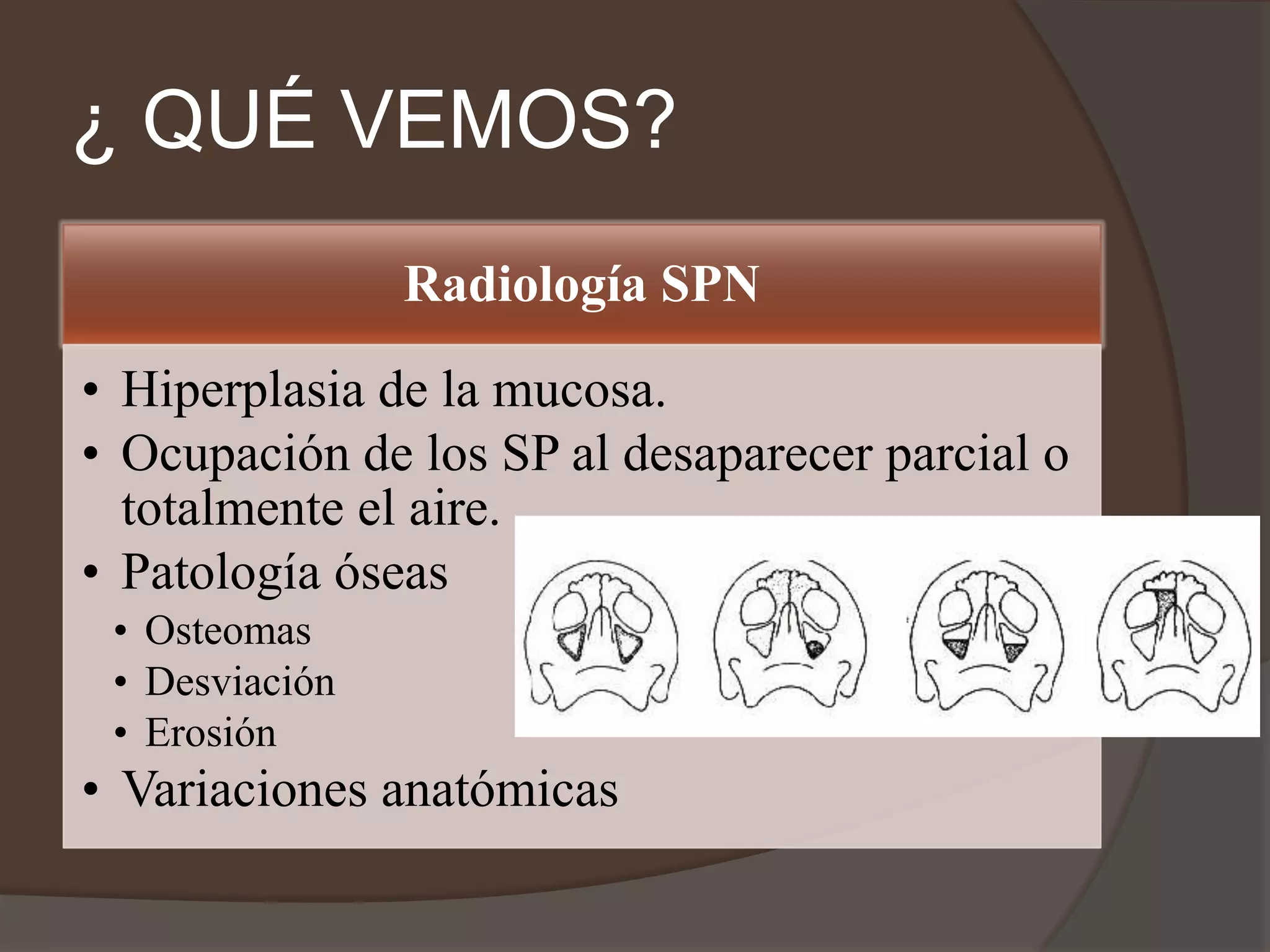 Semiologia de senos paranasales y radiologia y anatomia de seno maxil…