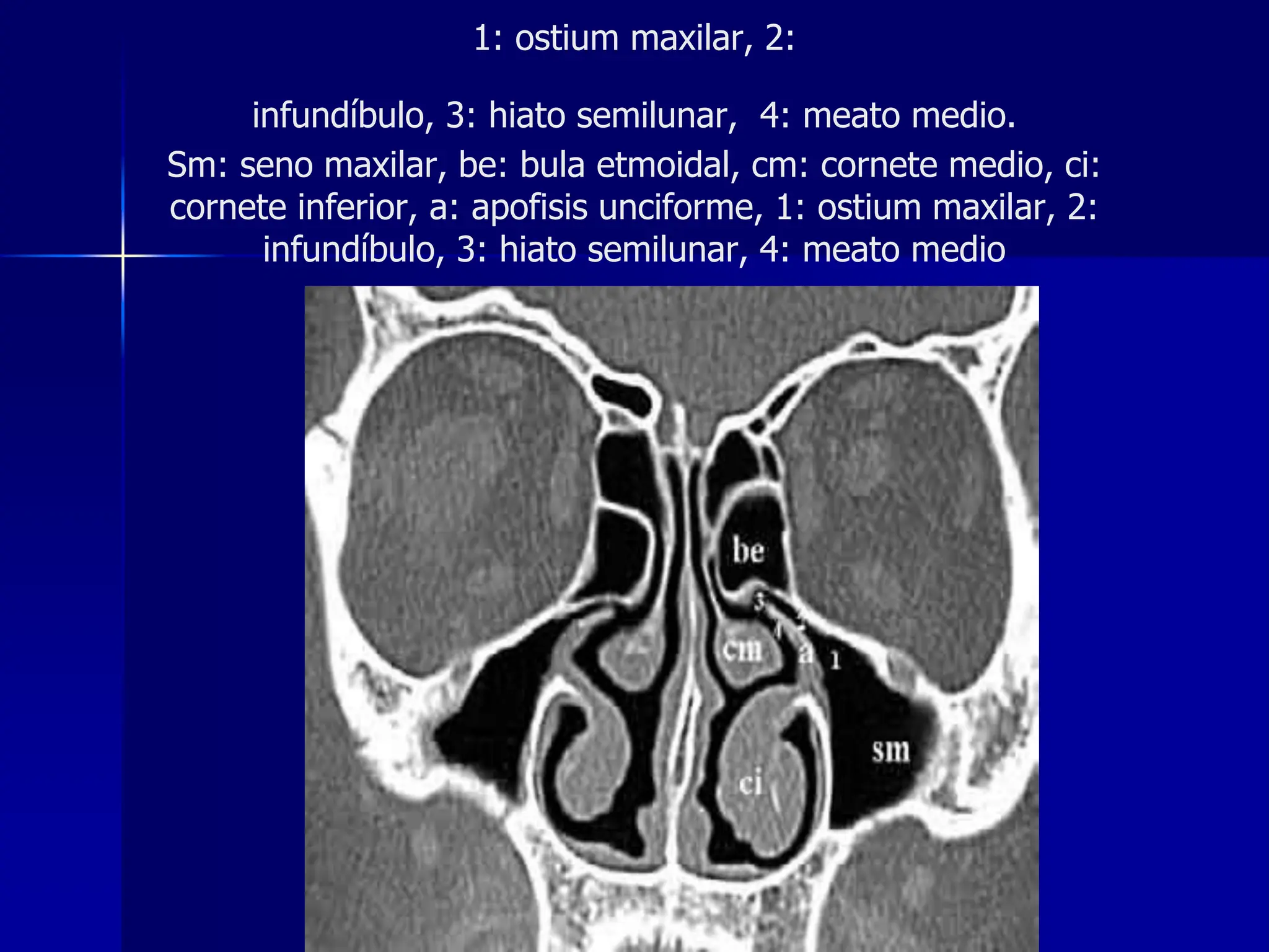 SEMIOLOGIA DE SENOS PARANASALES OTORRINOLARINGOLOGIA.ppt