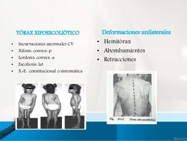 Semiologia de torax pediatrica