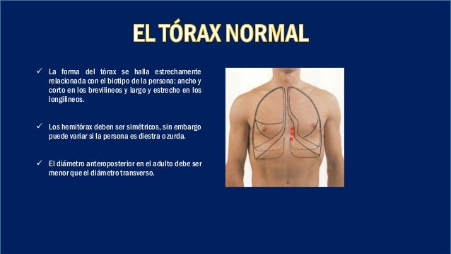 SEMIOLOGIA DE TÓRAX