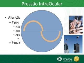 Semiologia do glaucoma | PPTX