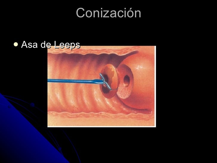 Semiologia exploracion ginecologica limpio