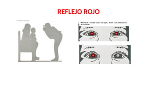 SEMIOLOGIA NEONATAL SIGNOS DE ALARMA.pptx