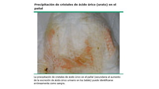 SEMIOLOGIA NEONATAL SIGNOS DE ALARMA.pptx