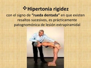 Semiologia del Sistema Nervioso | PPT