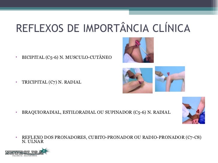 Semiologia neurológica matheus