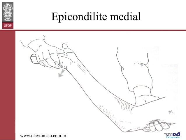 Semiologia ortopédica tjmg